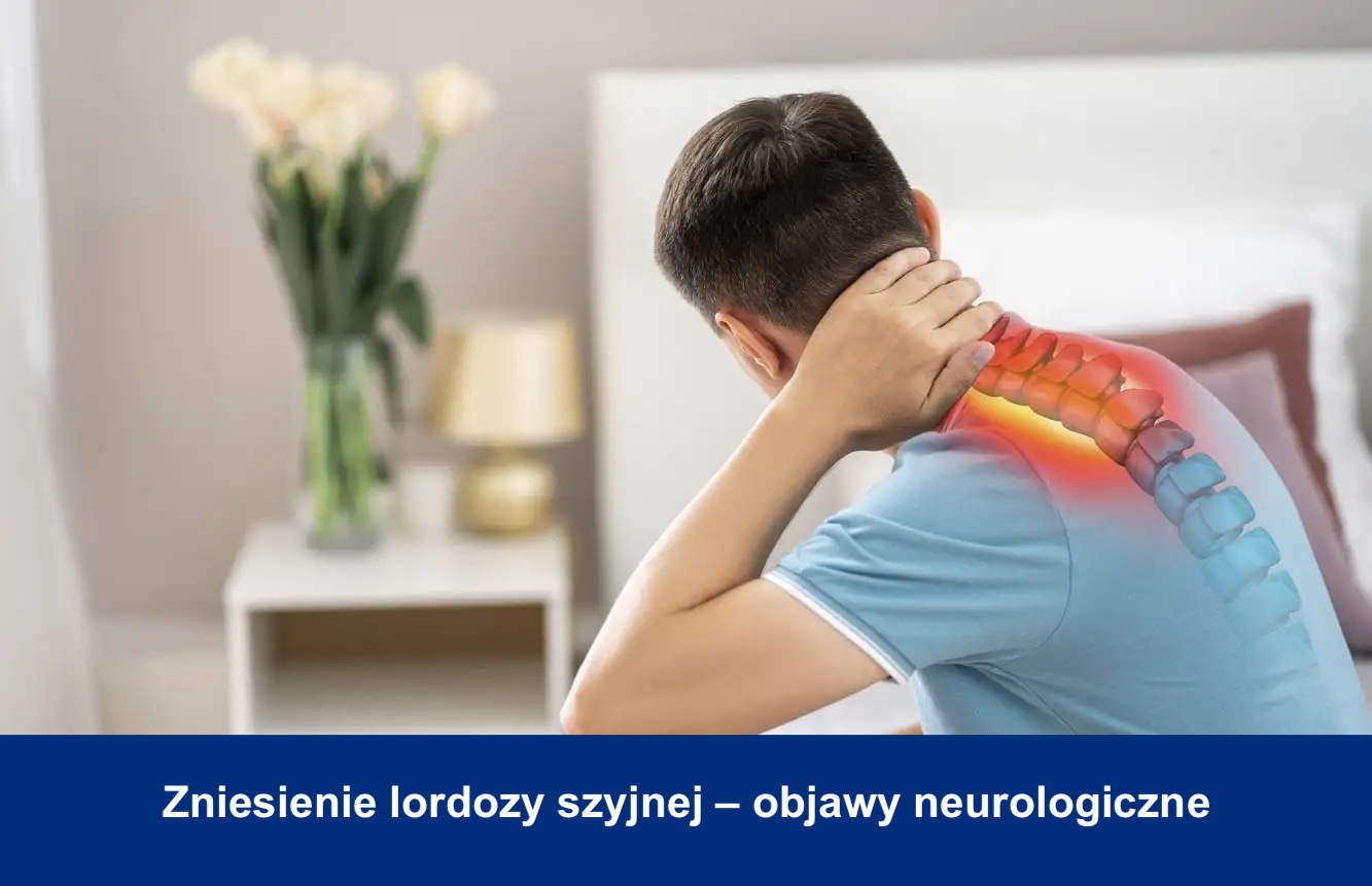 Zniesienie lordozy szyjnej - objawy, przyczyny i leczenie • ReceptaX